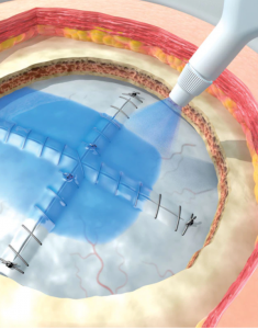Neurosurgery – Ajm